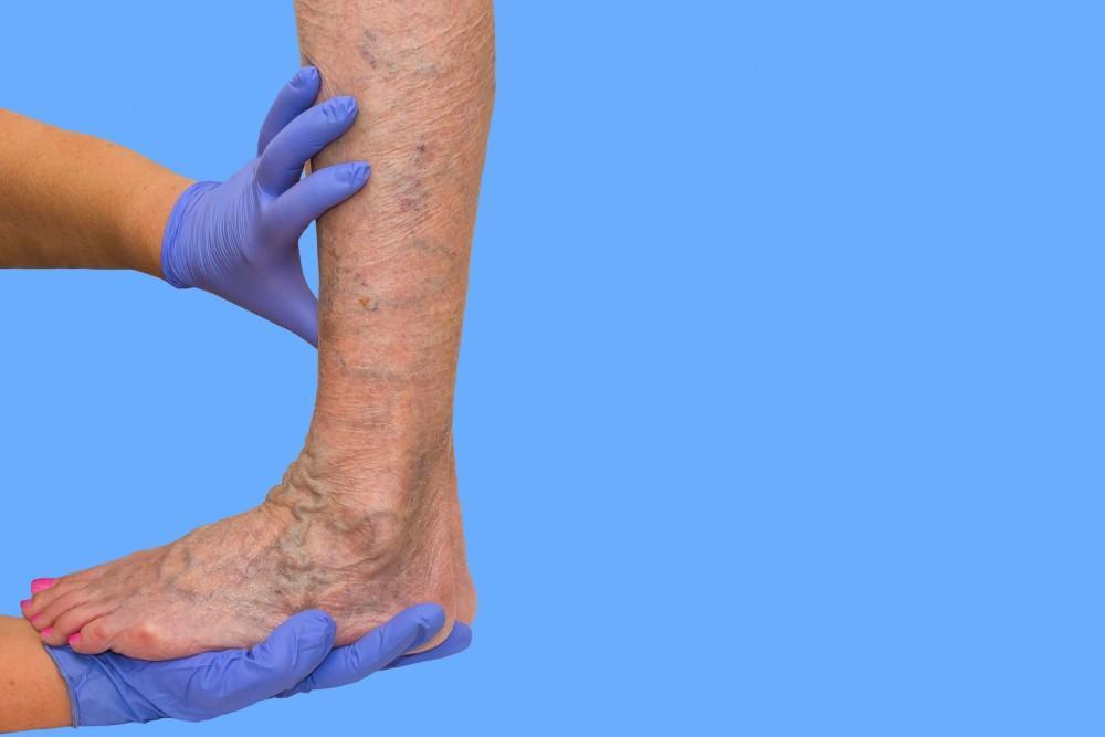 Major Circulation Diseases from Long-Term Medication Use: What Your Bo ...